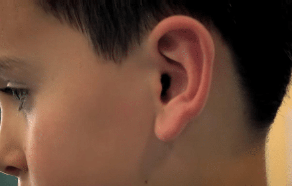 Boy Gets ‘Pencil’ Stuck In Ear, Doctor Pulls Out Something Much Worse ...