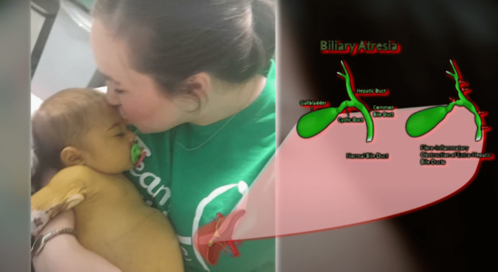 Daughter’s Belly Won’t Stop Growing: When Doctors Take a Look Inside ...