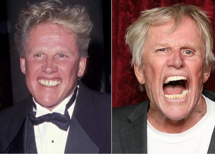 Hollywood Smiles Exposed Celebrities With The Most Shocking Dental ...