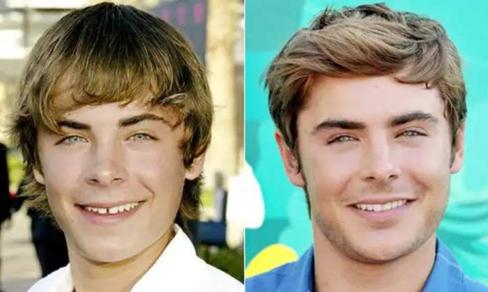 Hollywood Smiles Exposed Celebrities With The Most Shocking Dental ...