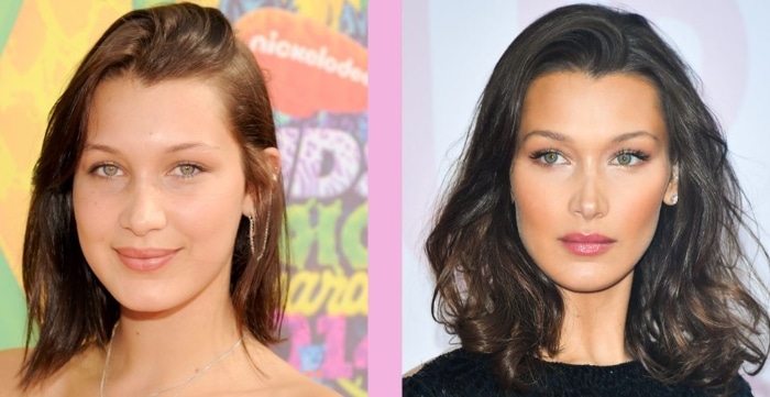 Shocking Transformations Revealed Celebrity Before And After Plastic ...